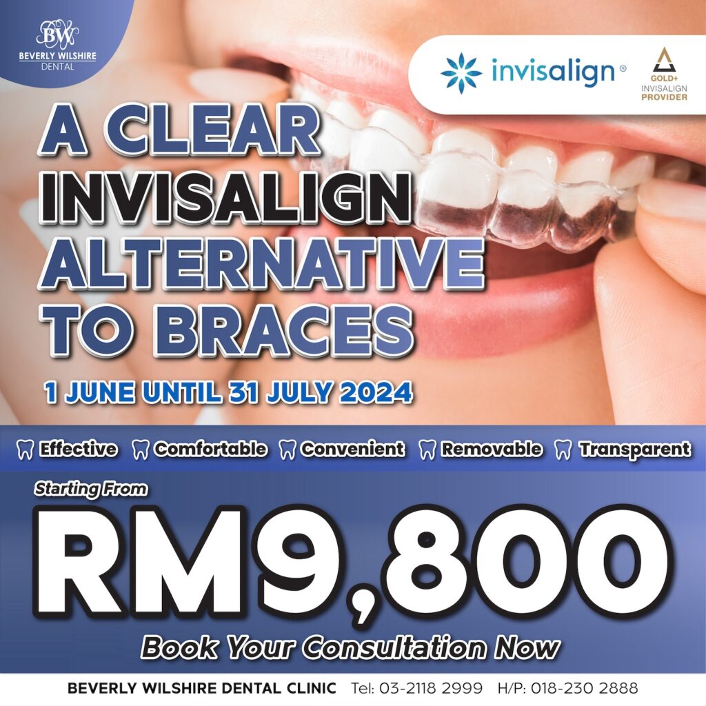 INVISIBLE BRACES – CLEAR ALIGNER PACKAGE - Beverly Wilshire Dental